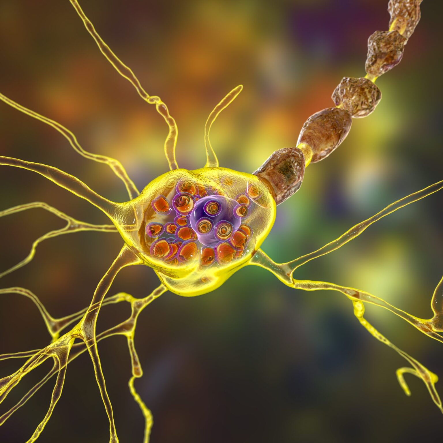 Mri Imaging Of Metabolic Disorders Accepted For Arrt® And Armrit