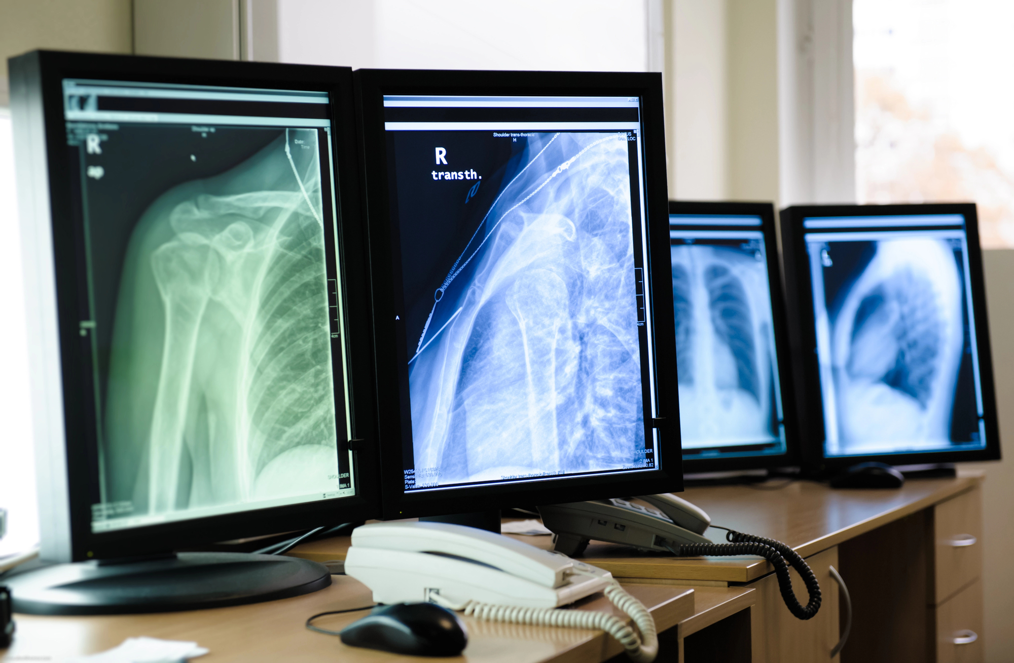 Understanding Digital Radiography and PACS - Get Your CEU